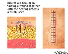 Nurs144 Exam 2 Quizlet