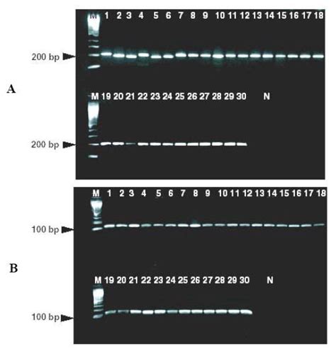 Pcr Amplification Of 16s Rrna Hypervariable Regions Of From 30 Download Scientific Diagram