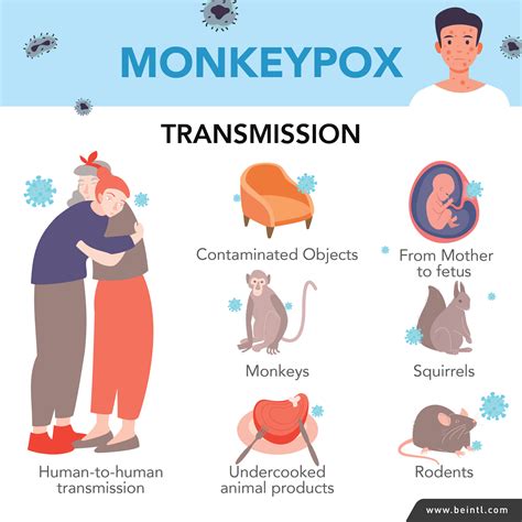 Monkeypox Outbreak: Understanding Symptoms, Risks, and Prevention ...