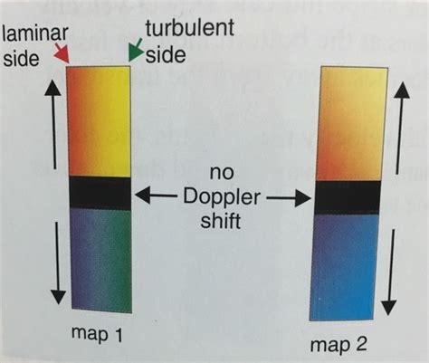 Doppler Review Quiz Flashcards Quizlet