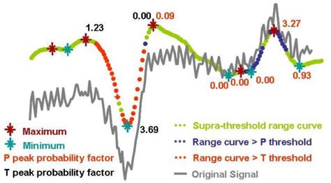 Figure 1 From Automated Qt Interval Measurement From Multilead Ecg Signals Semantic Scholar