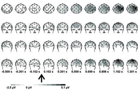 A Scalp Voltage Topography Of Oldnew Difference Collapsed Across Download Scientific