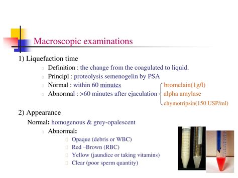 Ppt Semen Analysis And Sperm Processing Powerpoint Presentation Free