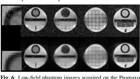 figure 6 from deep learning based method for denoising and image enhancement in low field mri