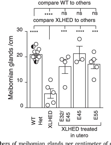 Figure 1 From Prenatal Treatment Of X Linked Hypohidrotic Ectodermal Dysplasia Using Recombinant