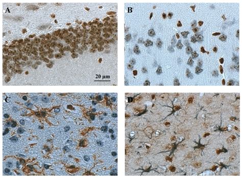 Anti Ding Anti Neun Double Staining Was Performed In Brain Sections Of Download Scientific
