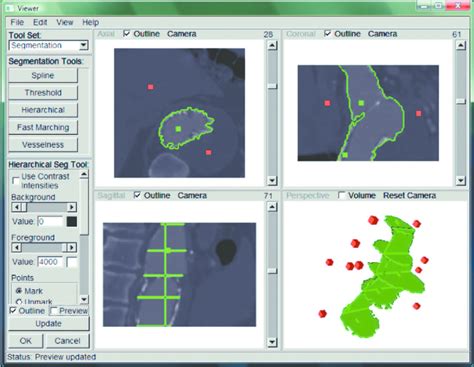 Applying Hierarchical Segmentation By Placing Interior Points Green