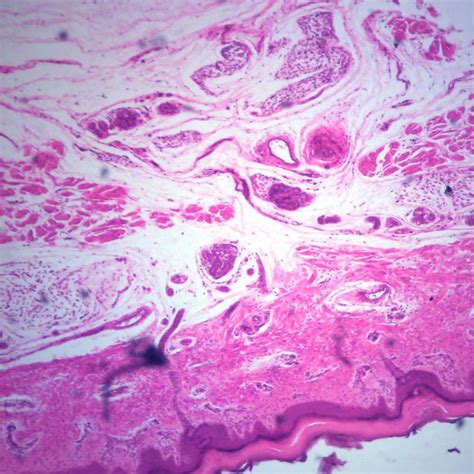 Human Skin Microscope