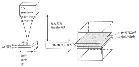 three dimensional ultrasonography based early liver cancer diseased
