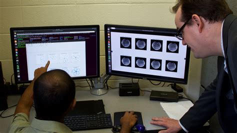 the computational biomedical imaging group cbig the university of iowa