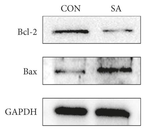 Sa Negatively Regulated Apoptosis Metastasis And The Wnt β Catenin Download Scientific