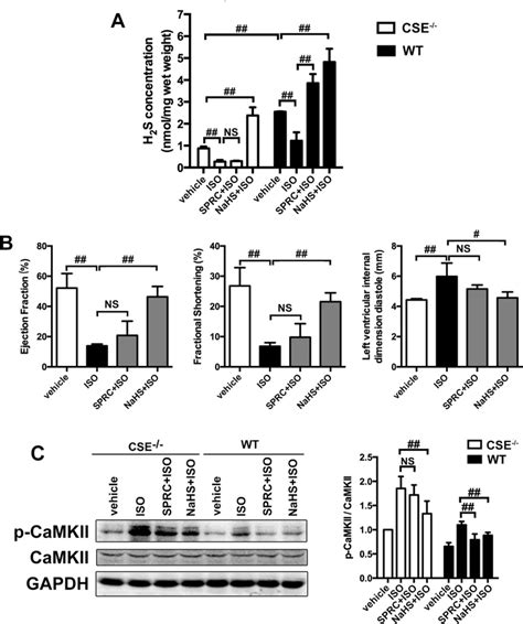 The Cardioprotective Effect Of H 2 S Donor Sprc Through Camkii Pathway