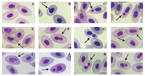 Photomicrographs Showing Cells With Normal Nucleus A And Nuclear