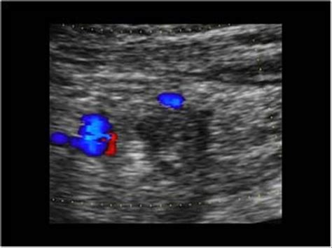 Peripheral Vessels 102 Peripheral Veins Case 1025 Venous System