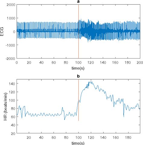 Figure 1 From Automated Epileptic Seizure Detection Based On Wearable
