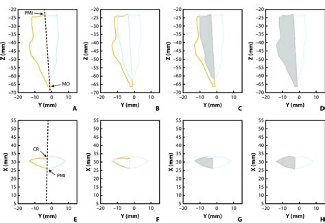Border Movements Of Participant Output Of Data Processing In Matlab