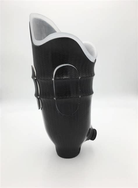 Adjustable Socket For Comfortable Prosthetic Fit Adjustable Socket For Comfortable Prosthetic Fit