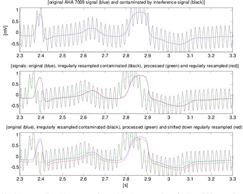 Figure 2 From Power Line Interference Removal From Ecg In Case Of Power