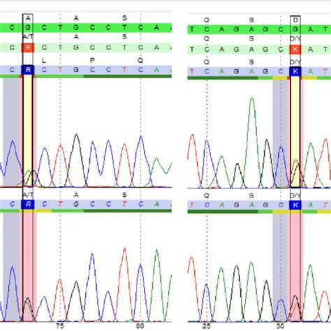 Adck4 Sequence Chromatogram Showing The Two Heterozygous Mutations