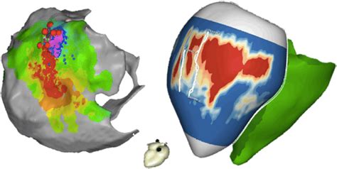 Comparison Of 3d Activation Map Showing Critical Isthmus Of An Download Scientific Diagram
