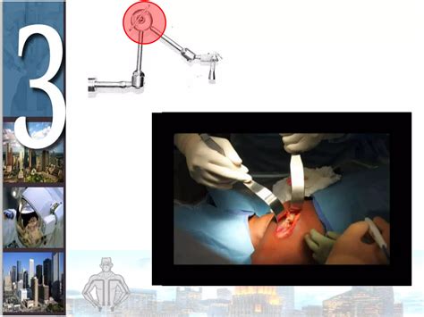 Houston 2011 Robotic Liver Resection For Neuroendocrine Metastatic Tumors Pptx Cancer