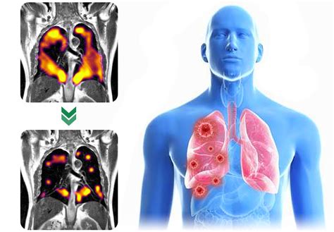 Gfouk™ Freshair Herbal Lung Cleanse Repair Patch G Fouk