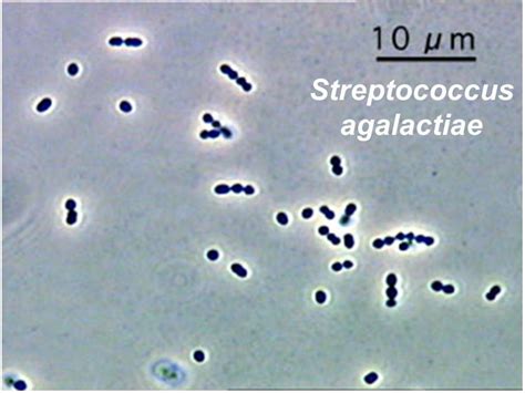 Streptococcus Agalactiae Drbeckmann