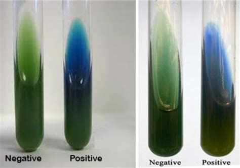 Citrate Utilization Test Flashcards Quizlet
