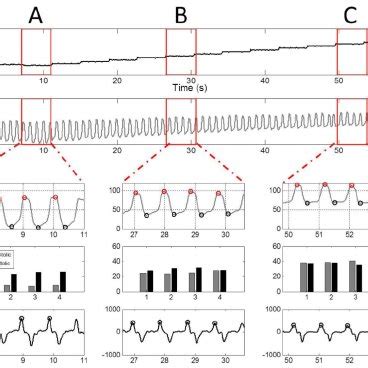 Pulsatile Versus Continuous Flow Ventricular Assist Devices Download Table