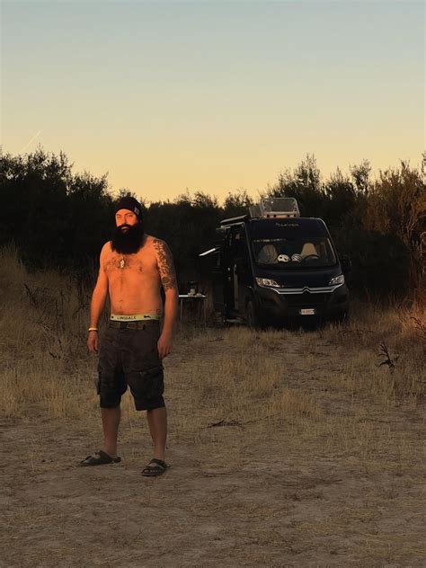 Can See Scalp Only When Hair Is Wet Is It Normal R Bald