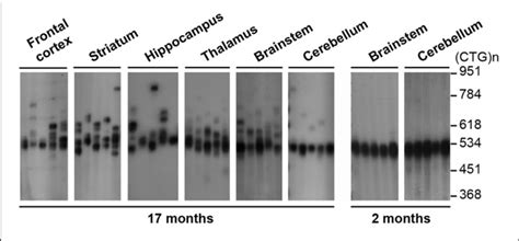Analysis Of Ctg Somatic Mosaicism In The Cns Of Transgenic Mice