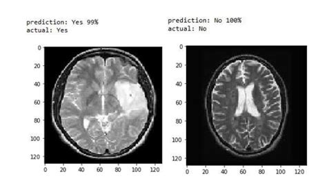 GitHub AHMEDSANA Binary Class Brain Tumor Classification In This We