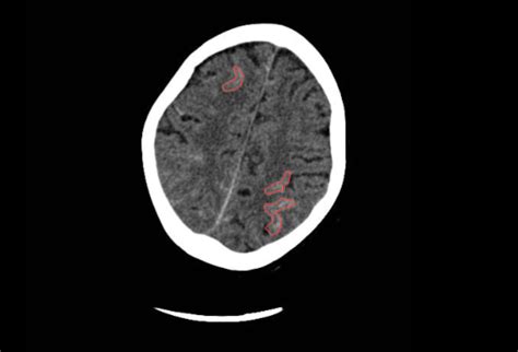 Emotion Detection Using Machine Learning By Paralleldots Medium