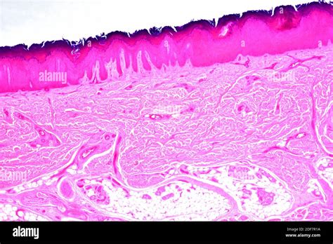 Stratified Squamous Epithelium Slide Labeled