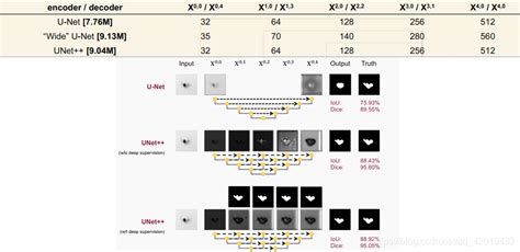 【论文阅读】unet、unet、unet3系列论文网络与研究思路解读deep Learning In Medical Image