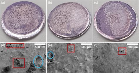 Postmortem Analysis By Digital Pictures Ac And Corresponding Sem