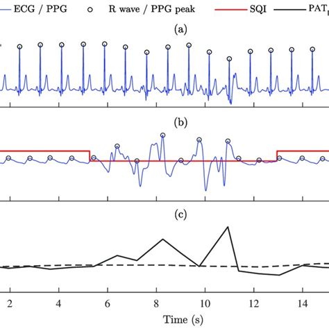 The Segmentation Of Low Quality Ppg Pulse Waves A Ecg Signal With Download Scientific