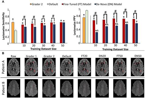 3d u net for automated detection of multiple sclerosis lesions utility