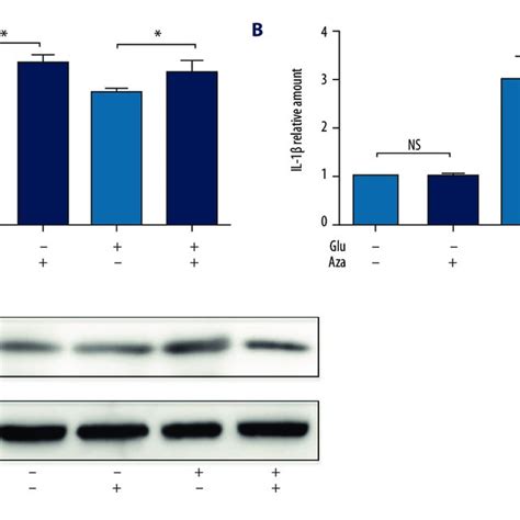 Azaserine Affects Txnip And Gs Expression In Muller Cells Rt Qpcr