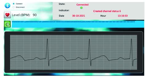 Graphical User Interface Of The Ecg Android Application In Which The