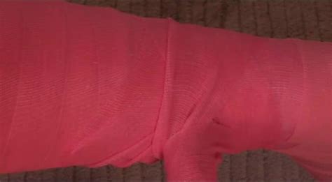 Full Body Cast Video Thisvid Com