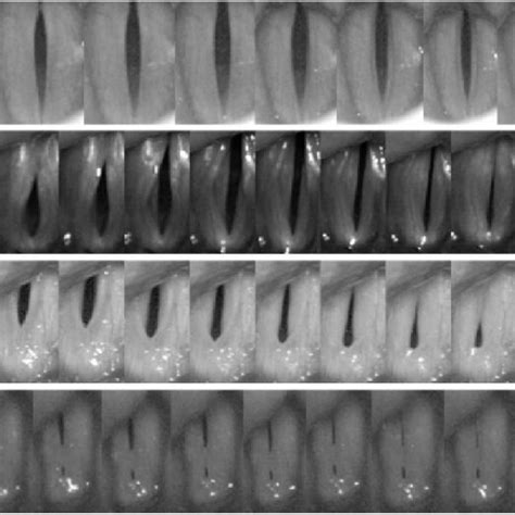 Vocal Fold Vibration Opening Onset Position A The Vocal Fold