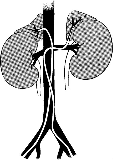 Adrenal Vein