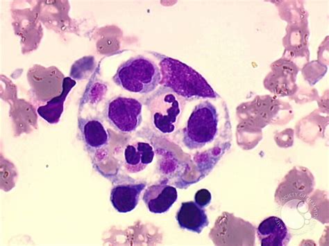 New Component Of Macrophage Metabolism Discovered Immunology