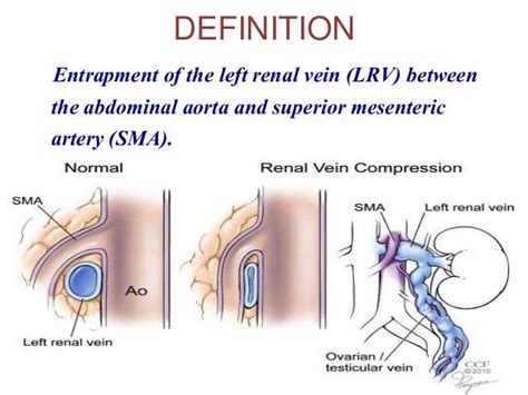 The Nutcracker Phenomenon Eds Foundation Netherlands