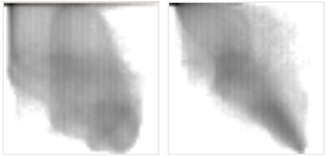 1 Joint Histogram Example The Images To Be Aligned Are Shown In A