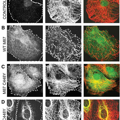 Expression Of Mutated Human Spastin Isoforms In Drosophila Cns Affects