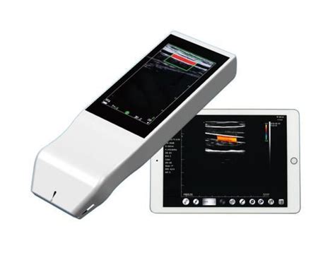 Wireless Linear Array Ultrasound Probe Handheld WiFi Medical Ultrasound Scanner Price For Sale