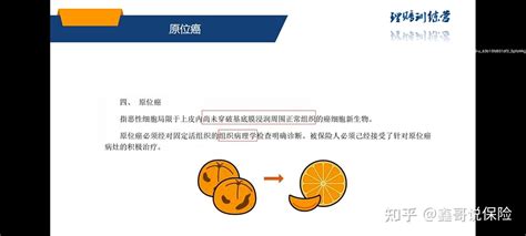 恶性肿瘤～重度与轻度的界定（一） 知乎