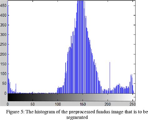 Figure 5 From Automatic Segmentation Of Optic Disc Using Modified Multi Level Thresholding